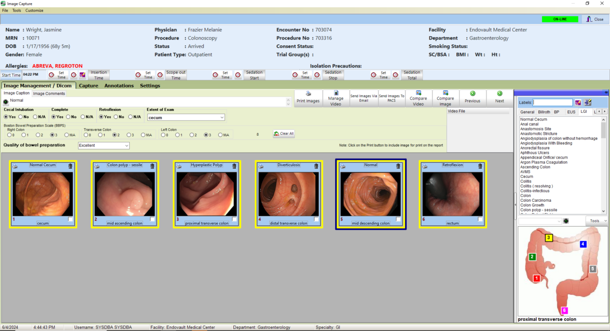 EndoVault® Endoscopy Image Capture and Epic® Lumens Integrate Seamlessly