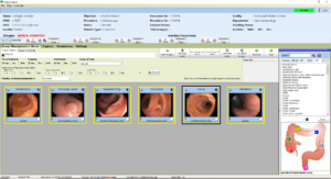 EndoVault® Endoscopy Image Capture and Epic® Lumens Integrate Seamlessly