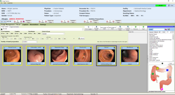 EndoVault® Endoscopy Image Capture and Epic® Lumens Integrate Seamlessly