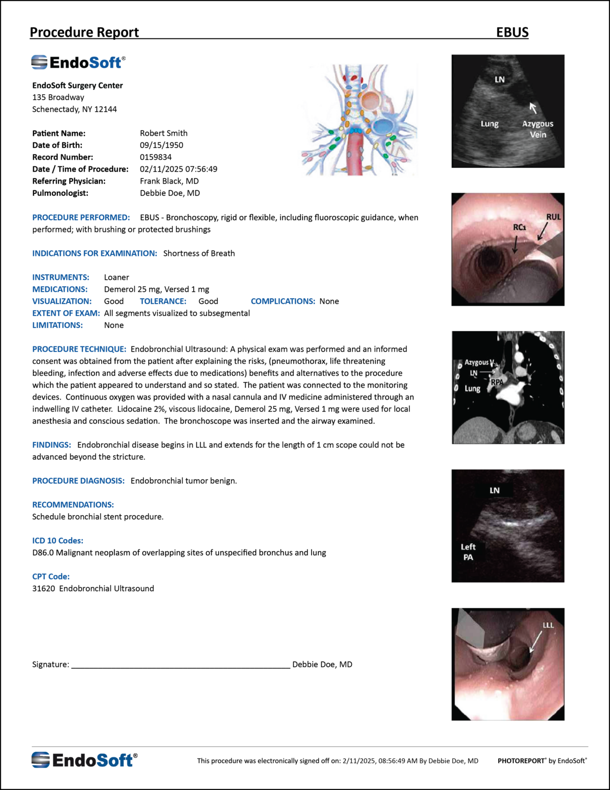 Integrated AI Image Management for Endoscopy | EndoSoft®