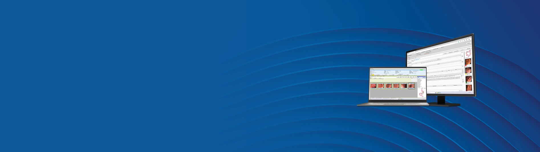 Endoscopy Electronic Health Record | GI Software | Gastroenterology EMR